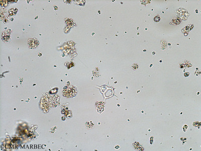 OREME DATA | Galerie de phytoplancton