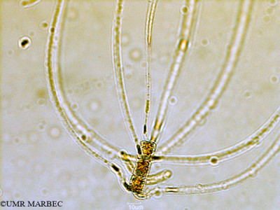 OREME DATA | Galerie de phytoplancton