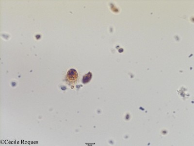 OREME DATA | Galerie de protozooplancton