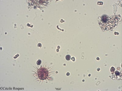 OREME DATA | Galerie de protozooplancton